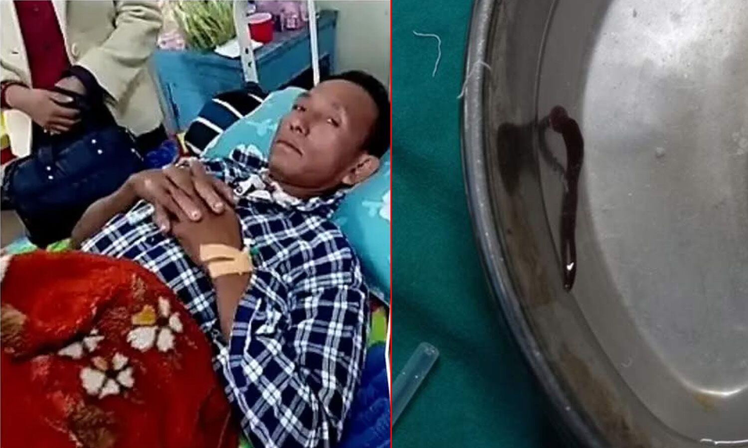 15 రోజుల పాటు గొంతులో ఇరుక్కుపోయిన జలగ.. ఆపరేషన్‌ తర్వాత సజీవంగా బయటకి ...